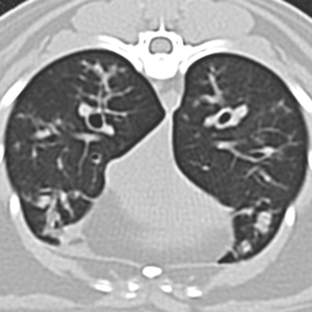 Atlas of Small Animal CT and MRI – Cases to illustrate, explain, and ...