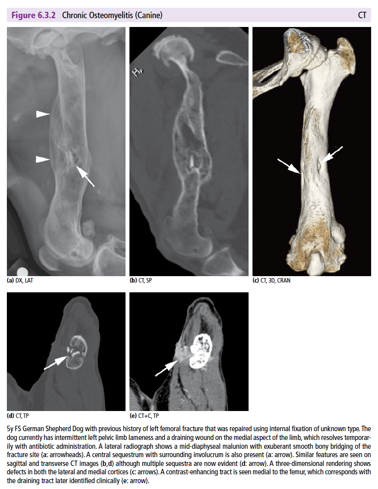 Differentiating types of aggressive bone lesions