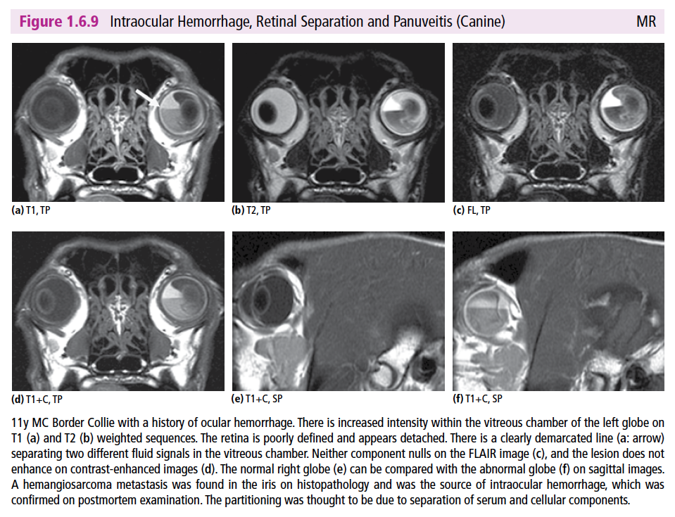 How to interpret CT and MR images of the globe
